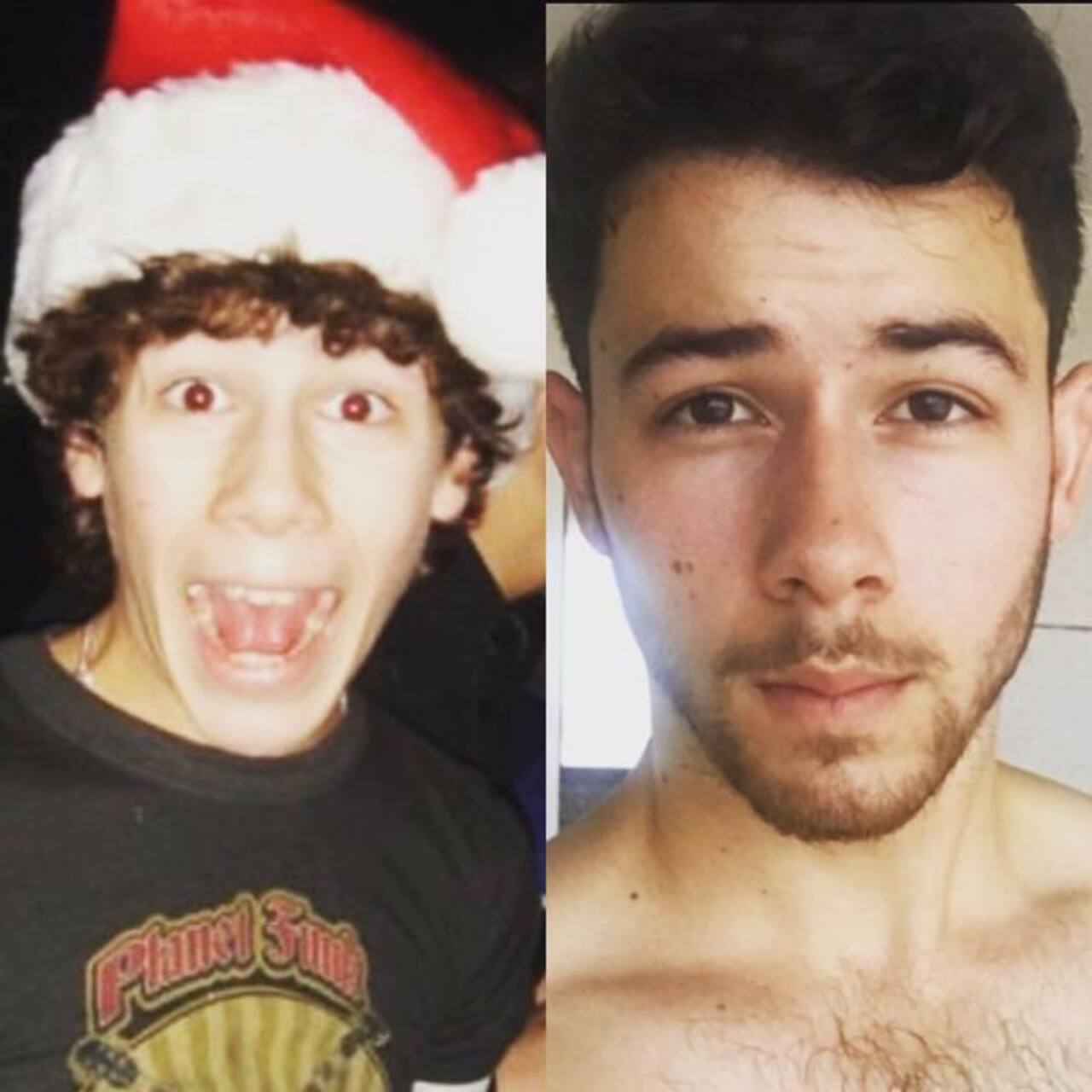 '13 years ago today I was diagnosed with type 1 diabetes,' Nick Jonas ...