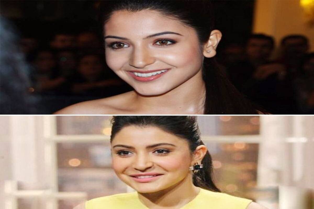 Anushka Sharma Before After