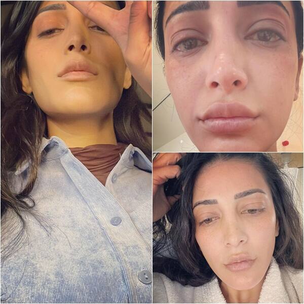 Before Shruti Haasan, Katrina Kaif, Kiara Advani and more Bollywood ...