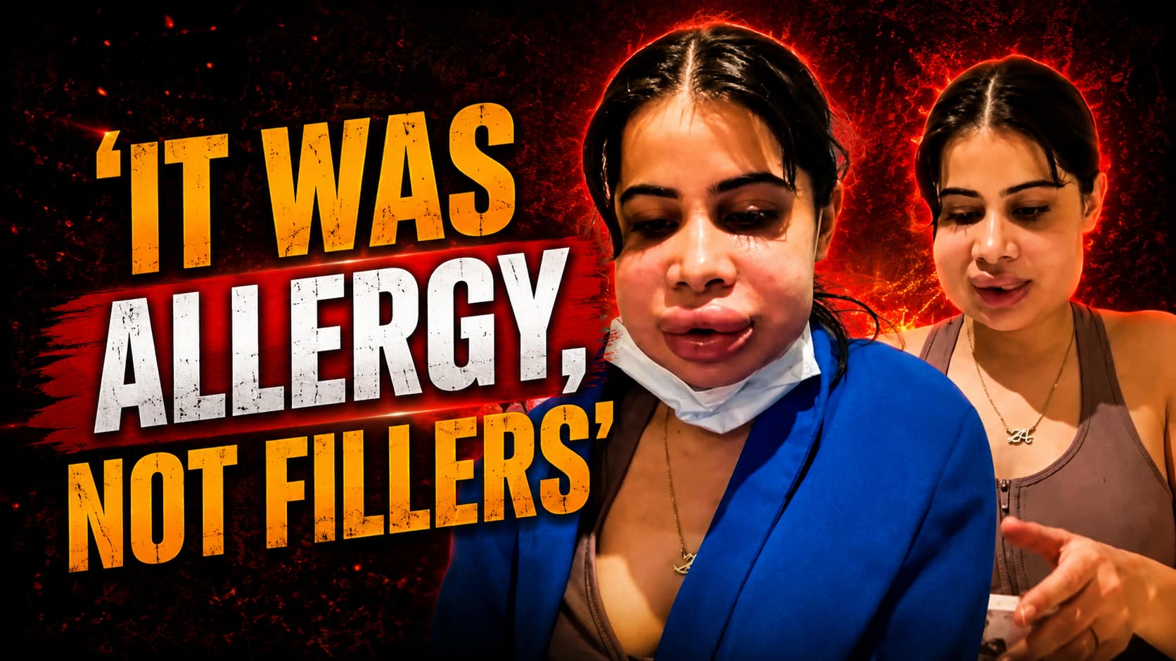 Uorfi Javed DEBUNKS cosmetic surgery rumours, blames ‘Stress, cortisol ...